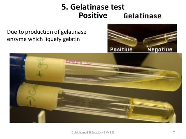 Gelatin Hydrolysis Test | Principle, Uses, Media, Procedure and Result ...