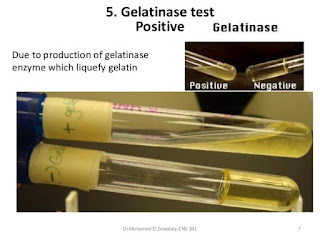 Gelatin Hydrolysis Test | Principle, Uses, Media, Procedure and Result ...