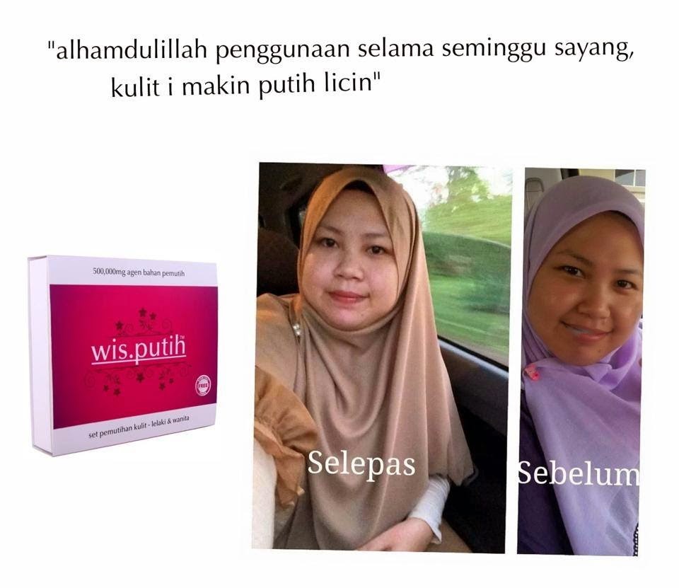 Produk Kecantikan & Kesihatan: WIS PUTIH SKINCARE FREE HYDROKINON
