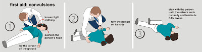 Aunty Nurse: First aid for seizures