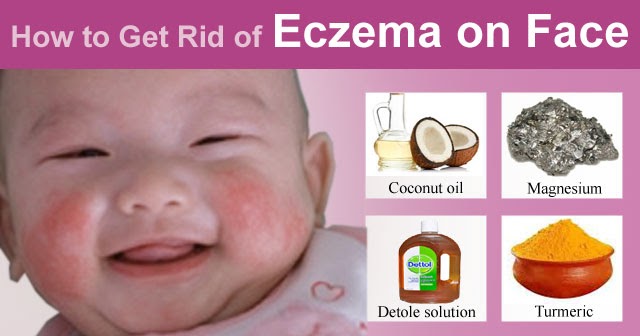 How to Get Rid of Eczema on Face by Using Home Remedies | Arbkan