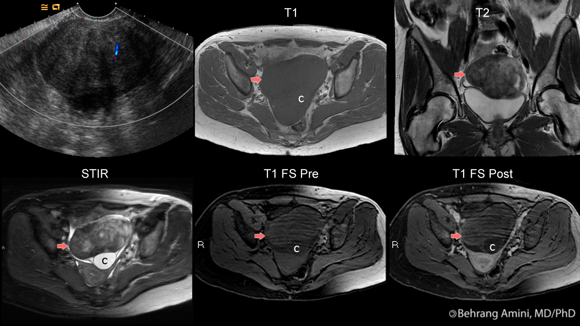 Roentgen Ray Reader: June 2011