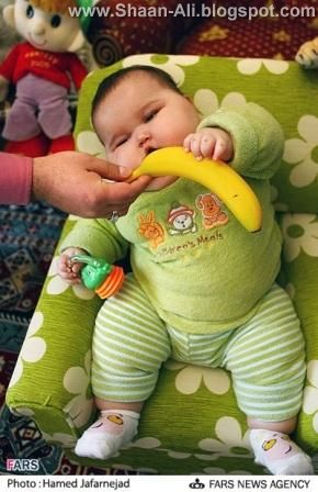 Original Facts: 20 kg baby born in Tehran, Iran Unbelievable Pictures
