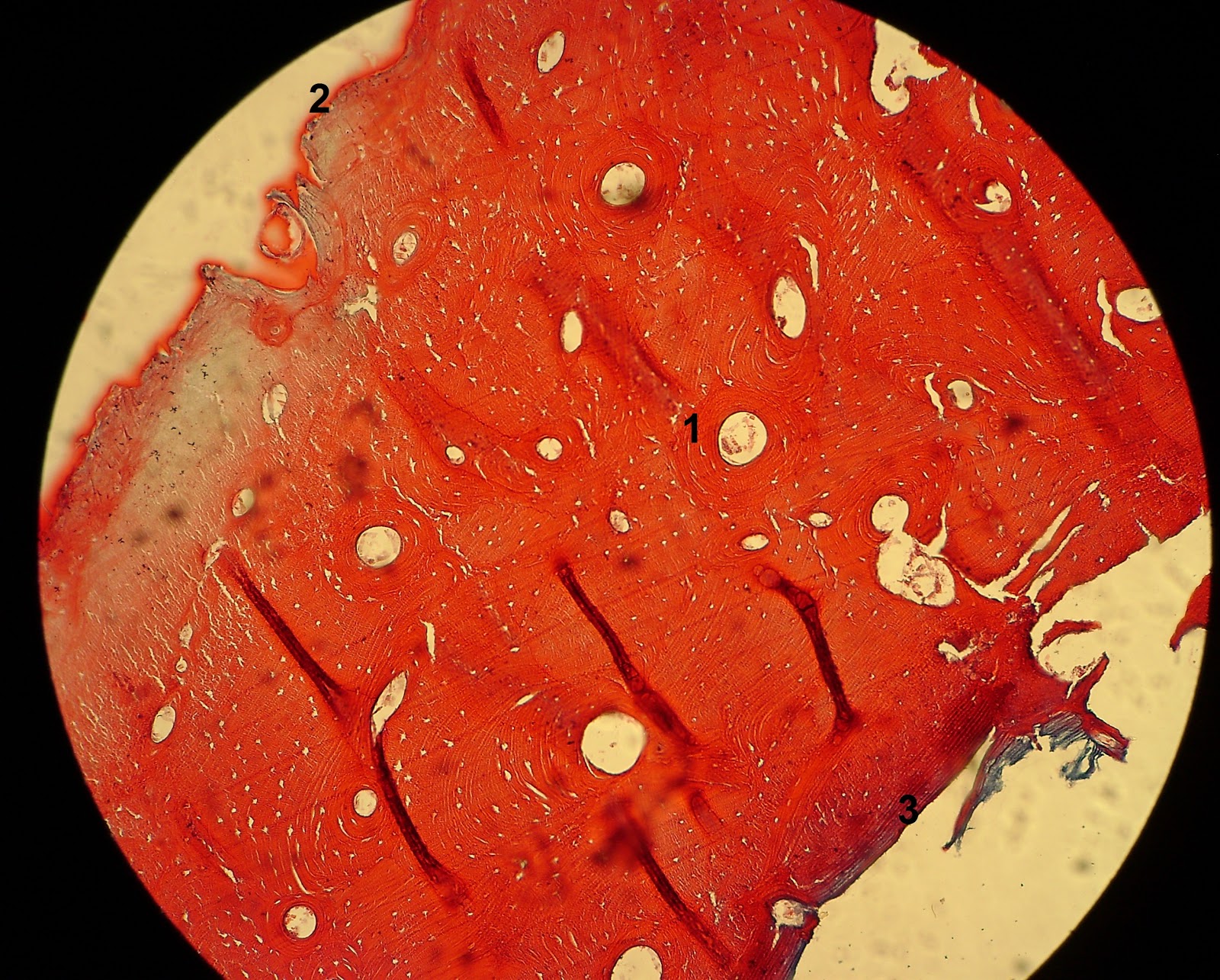 Histologia UFJF: Tecido Ósseo - Osso Compacto