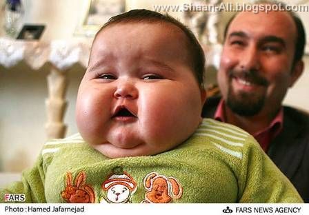Original Facts: 20 kg baby born in Tehran, Iran Unbelievable Pictures