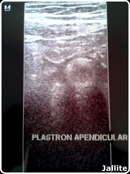 Plastron Apendicular