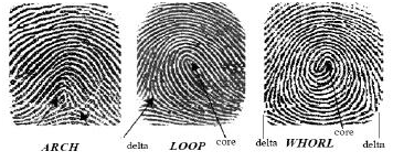Pola Pembentukan Sidik Jari (Dermatoglifi): Loop, Arch, dan Whorl
