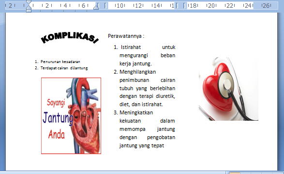 CONTOH LEAFLET GAGAL JANTUNG KONGESTIF / CONGESTIVE HEART FAILURE - Be ...