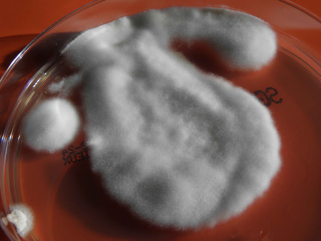 ATLAS MICOLOGIA: TRICHOPHYTON INTERDIGITALE