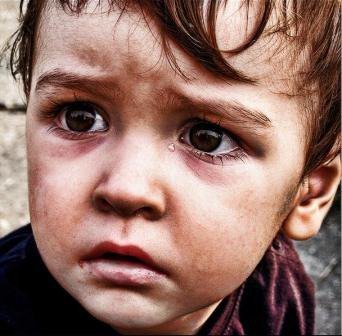 sourire-d-enfance: Syndrome des enfants battus(Syndrome de Silverman)