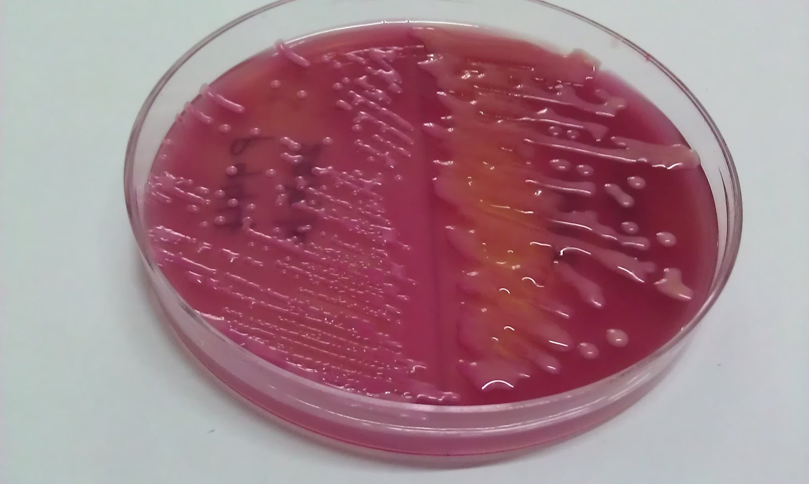 ENDO Agar - Microbiology Laboratory Turkey