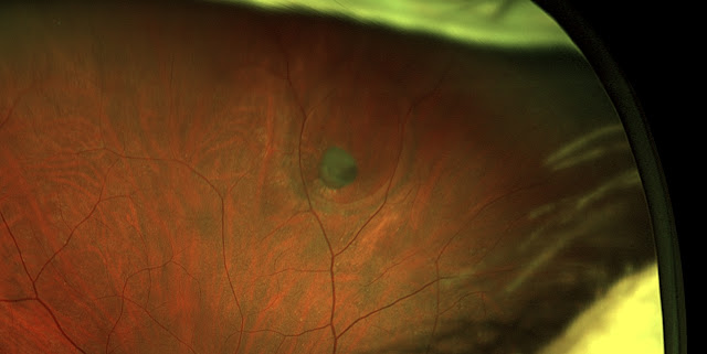 Sonoran Desert Eye Center