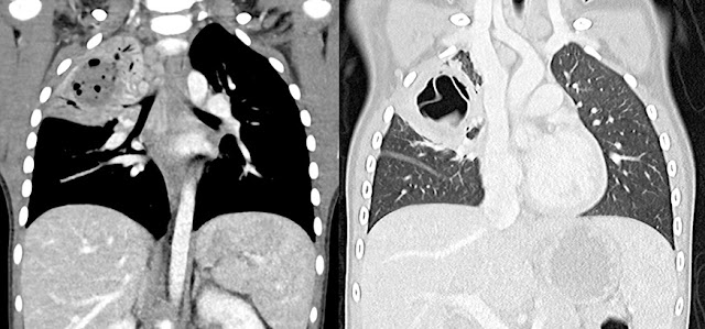 HealthforHeart: water-lily sign