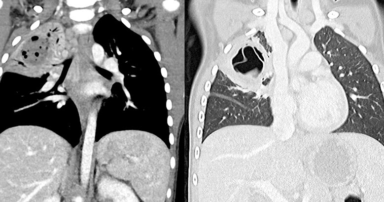 HealthforHeart: water-lily sign