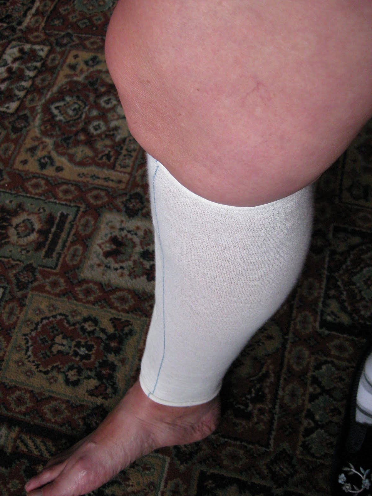 Gills RSD (CRPS): JULY-OUCH