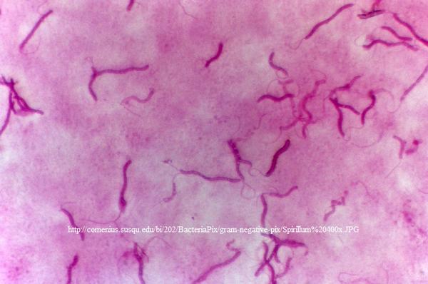 BACTERIAL MORPHOLOGY Contd...