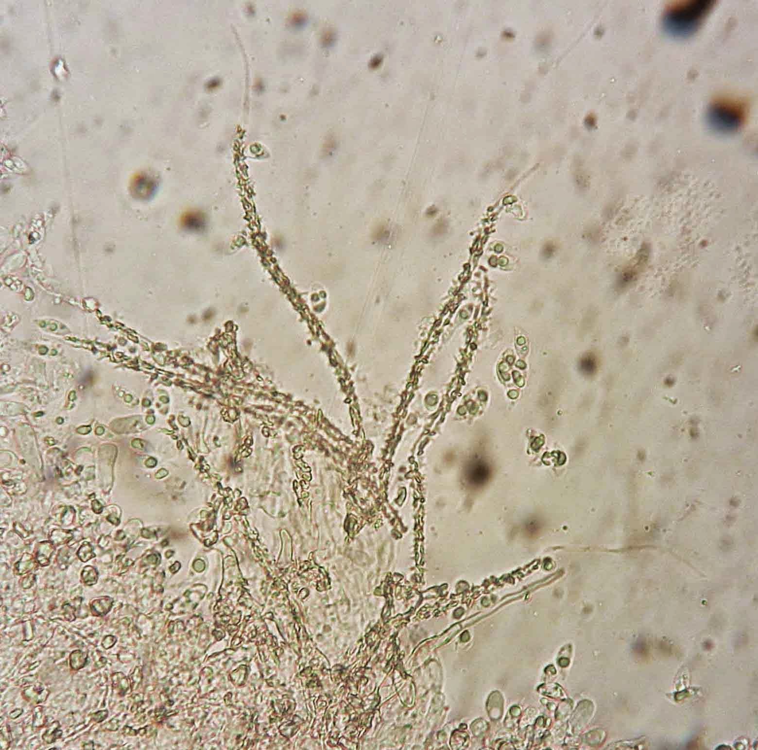 Flagelloscypha - Alchetron, The Free Social Encyclopedia