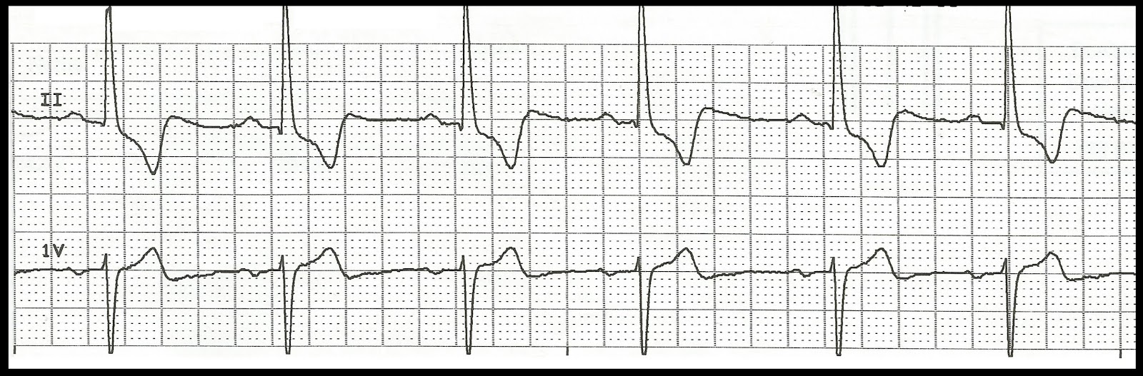 Practice EKG Rhythm Strips 187