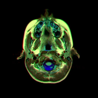 Nevit's blog: Color MRI of the Brain