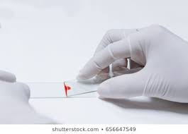 Cindy's Lab Life: Smearing techniques: How good do you smear?