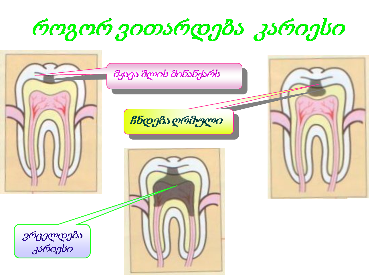 ლალი მაისურაძე: გაკვეთილები