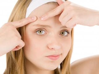 The Science behind Adult Acne and What Steps to Take | Beauty and ...