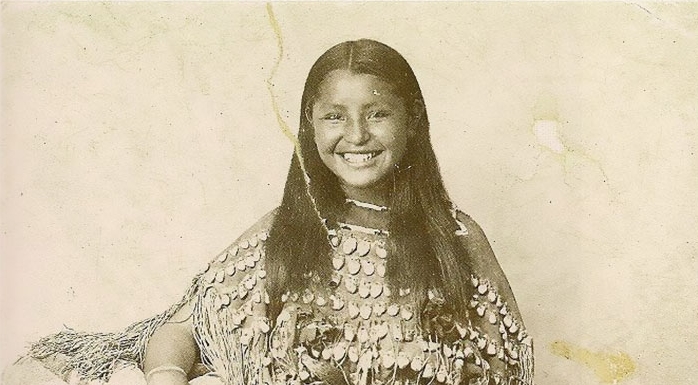 Irish White Skin Native American