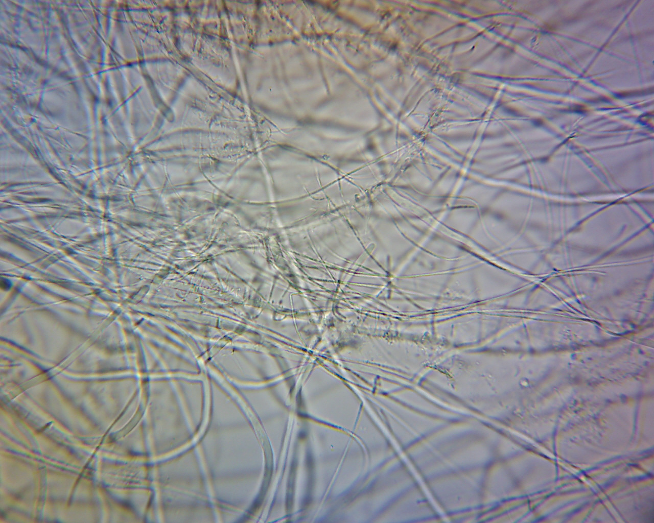 Two Years and Three Months of Cyanobacteria