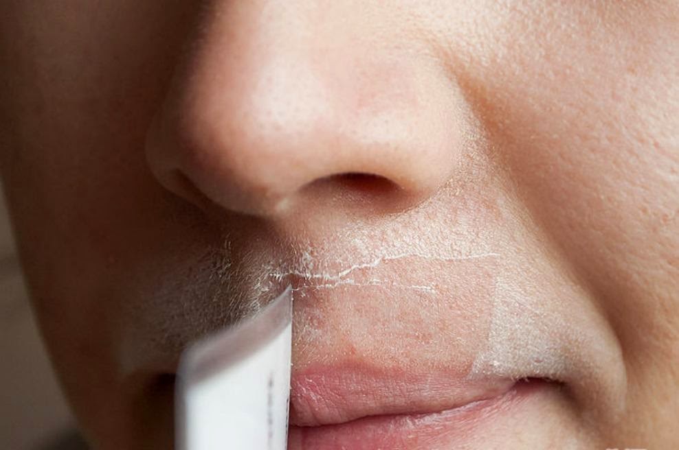 TIPS PARA DECOLORAR LOS VELLITOS DE TU PIEL | Medicina Total