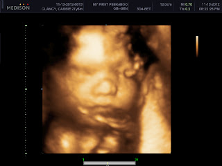 California Clancys: 28 weeks! 3D ultrasound!