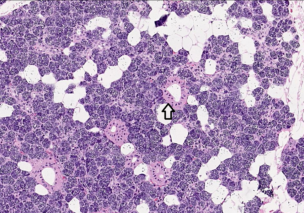 μicroscopia: PAROTIDE