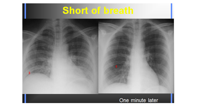Positioning and Related Anatomy for X-ray Imaging