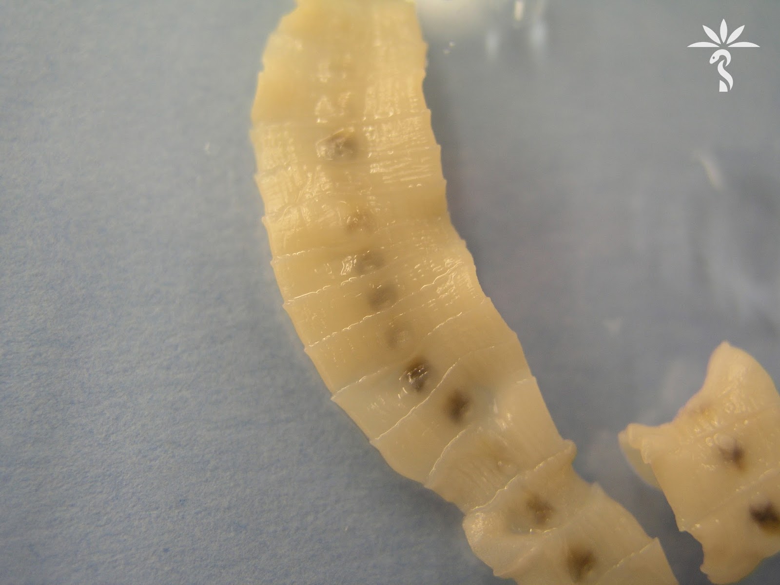 Creepy Dreadful Wonderful Parasites: Answer to Case 488