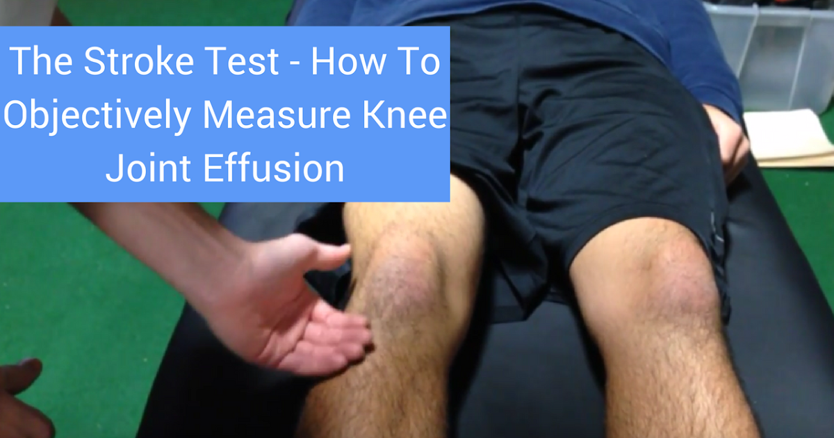 The Stroke Test - How To Objectively Measure Knee Joint Effusion ...