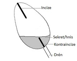 Kittanya: Léčení rány (všeobecné zásady a první ošetření rány)