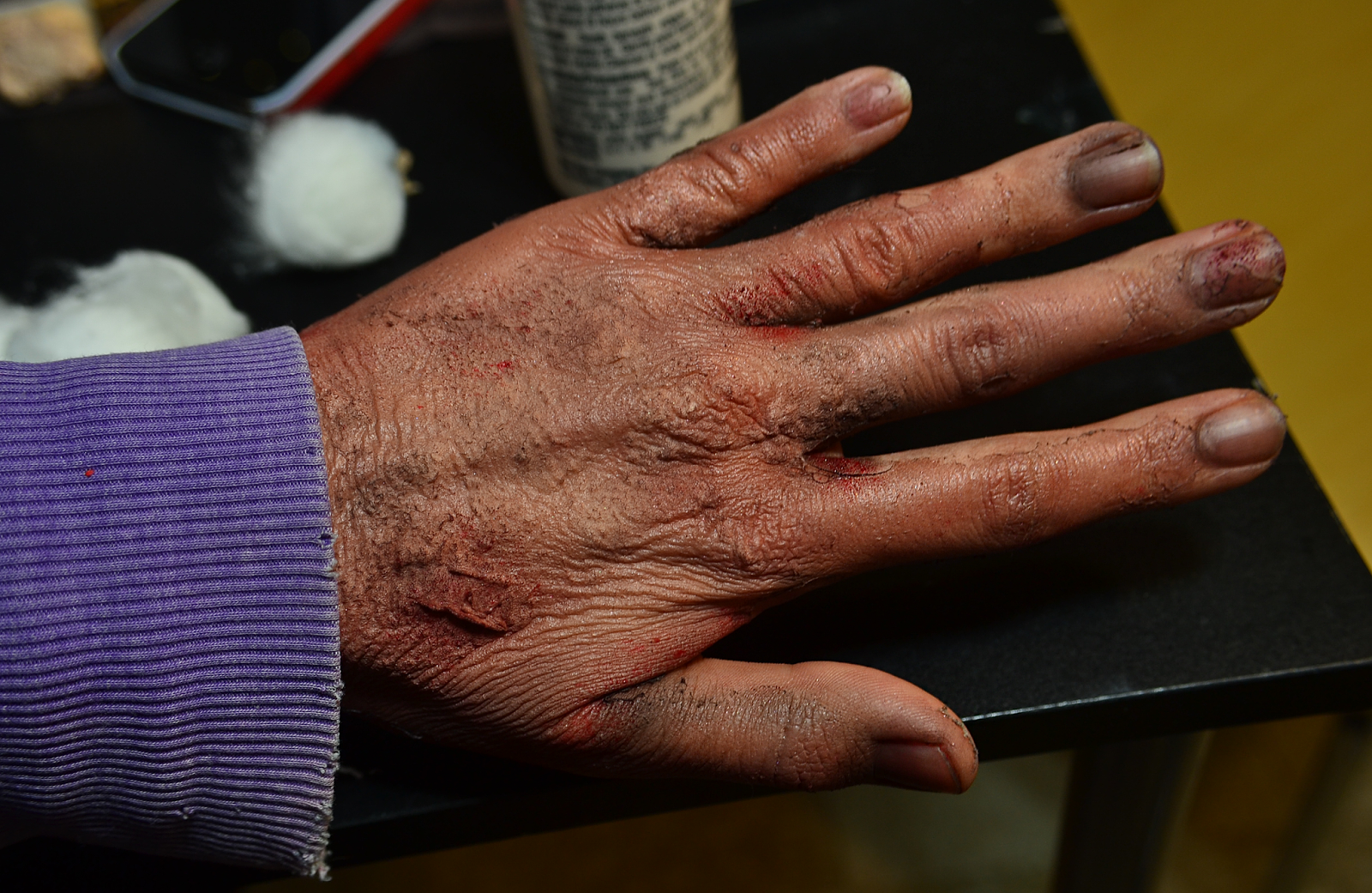 Eight-Bit Beauty: Halloween Week | Burned Hand