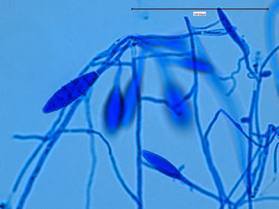 Fun With Microbiology (What's Buggin' You?): Microsporum gypseum