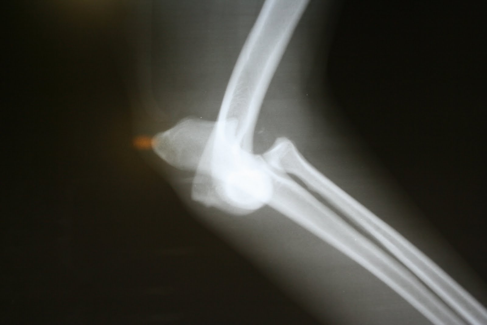 Traumatologia y Cirugia Ortopedica Veterinaria: LUXACION DE CODO