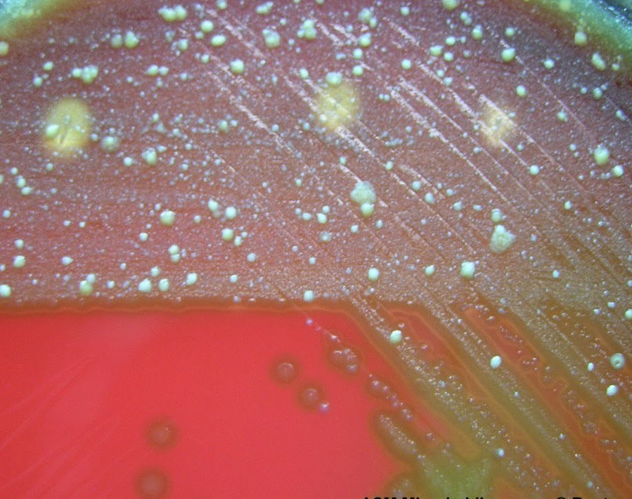 Blood Agar Plate Dan Uji Hemolisi