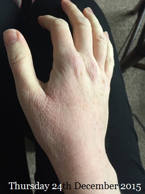 Hand-some | TSW Cara