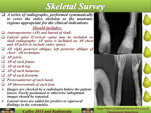 Easy Radiology: Skeletal survey & joint radiograph checklist