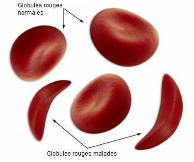 Globule rouge normal - Jessica Lessieur
