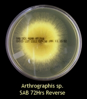 Fun With Microbiology (What's Buggin' You?): Arthrographis species