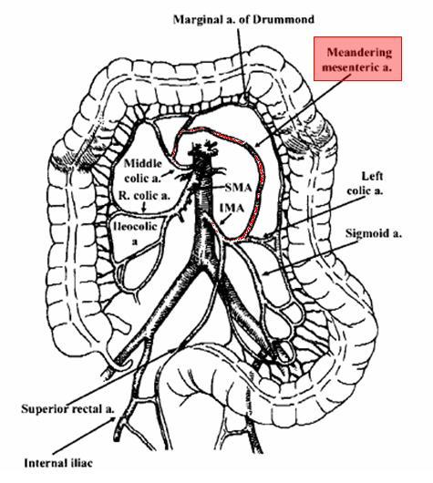 The Pump and the Tubes: Arc of Riolan / "meandering mesenteric artery"