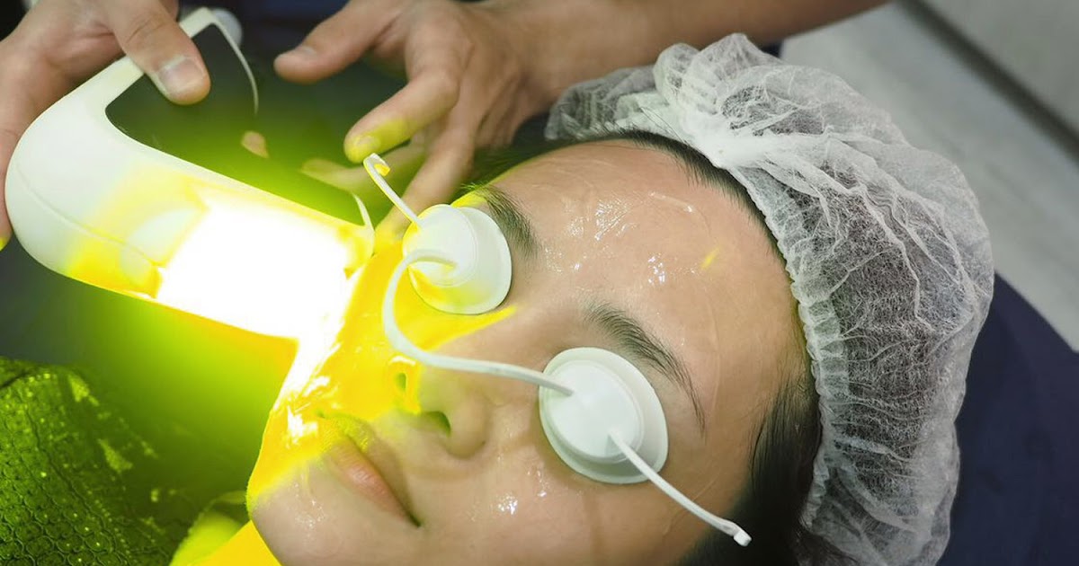 The Makeup Box: Pro Yellow Laser - A Safer Way to Remove Freckles ...