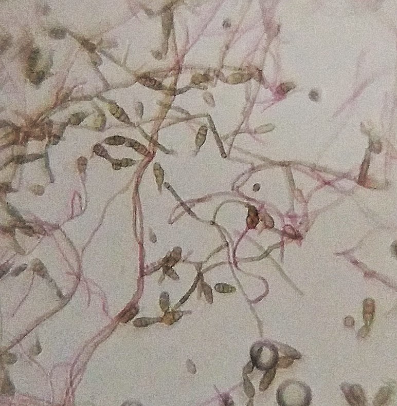 Sustainable Mycology: Foldscope images - Alternaria spp.