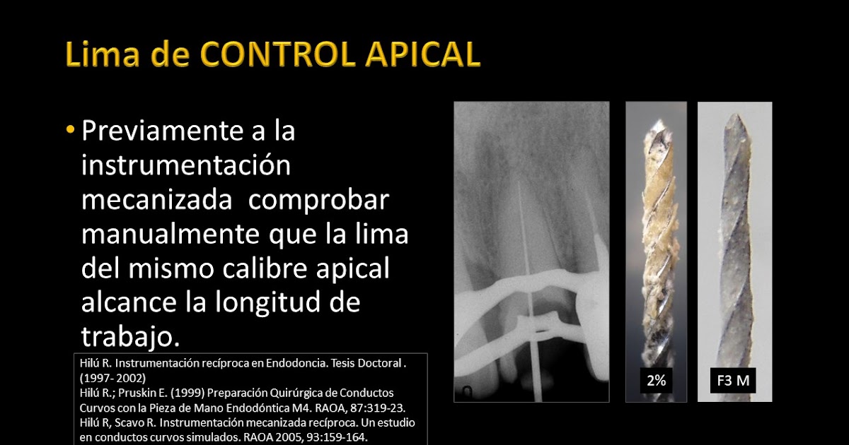 Lima de control apical