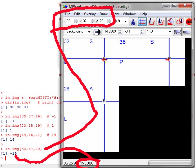 MVPA Meanderings: working with NIfTI files in R: oro.nifti code