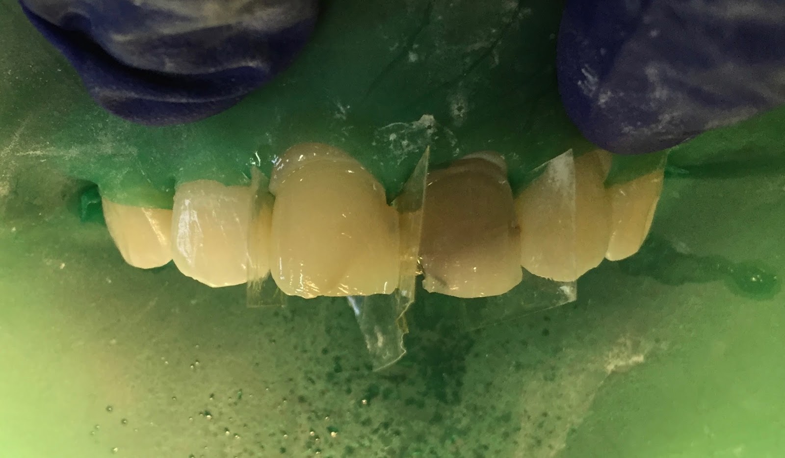 Smiles that make a Difference