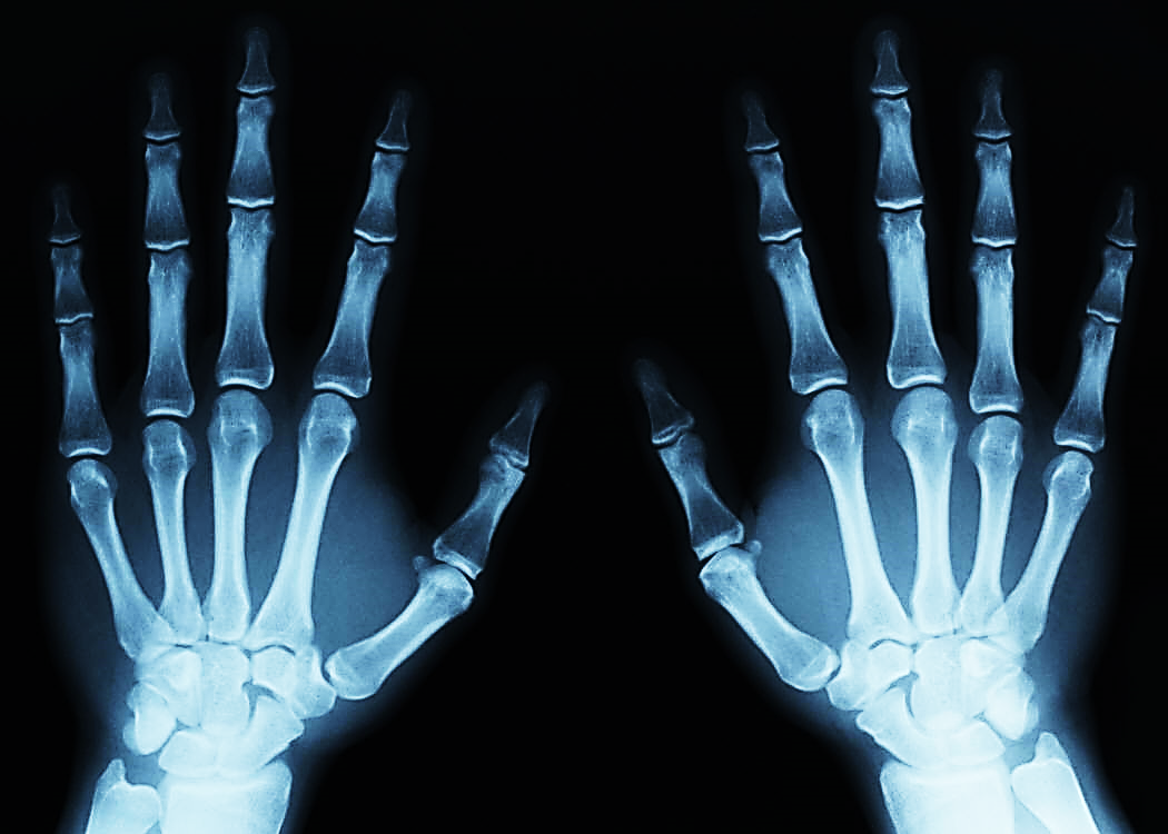 25+ Gambar Animasi Radiologi